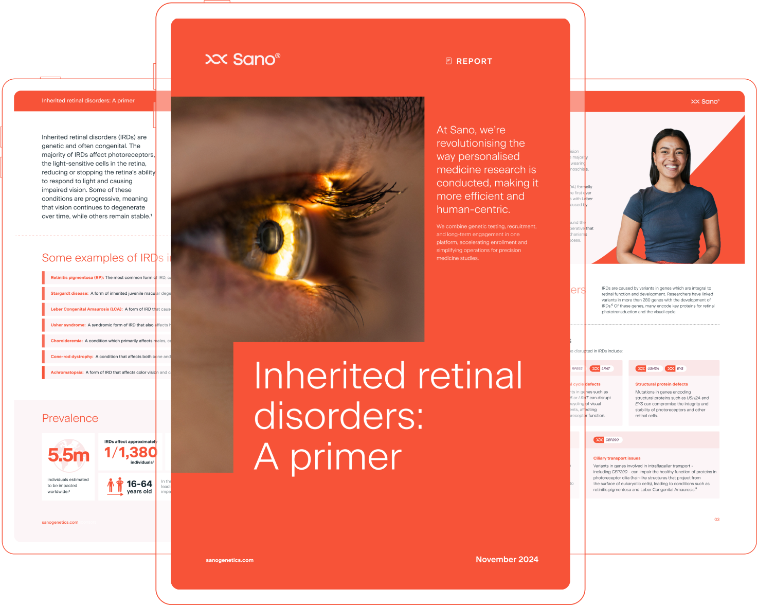 Exploring inherited retinal disorders (IRDs): Causes, challenges, and ...